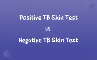 GTI vs. TI: What’s the Difference?